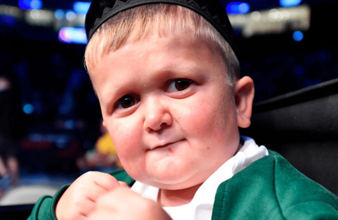 Hasbulla Is Coming To Australia (And We Finally Have Tour Dates)